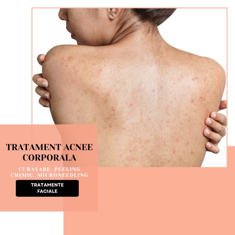 Tratamentul Facial HIFU - Nobelle Beauty Clinic